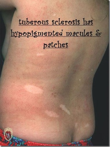 Medicine Decoded: skin lesions